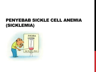Sickle Cell | PPTX
