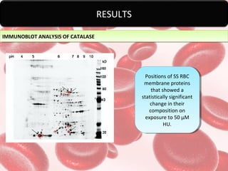 Sickle cell hu | PPT
