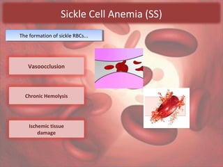 Sickle cell hu | PPT