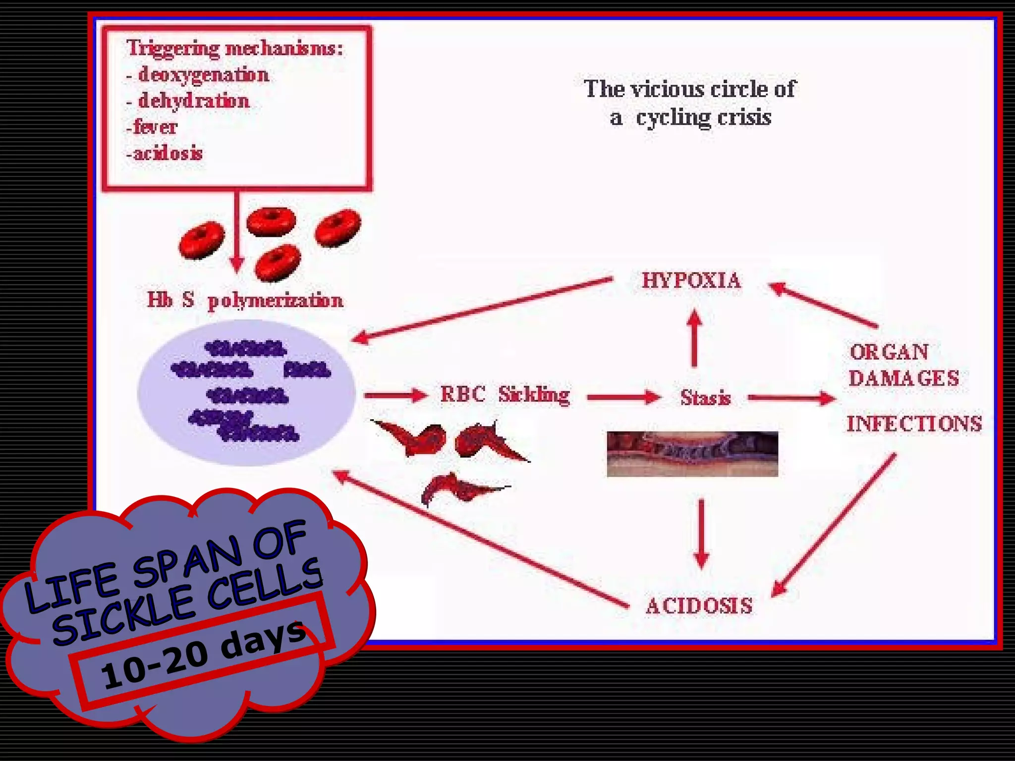 Sickle Cell Anemia | PPT | Blood Disorders | Diseases and Conditions