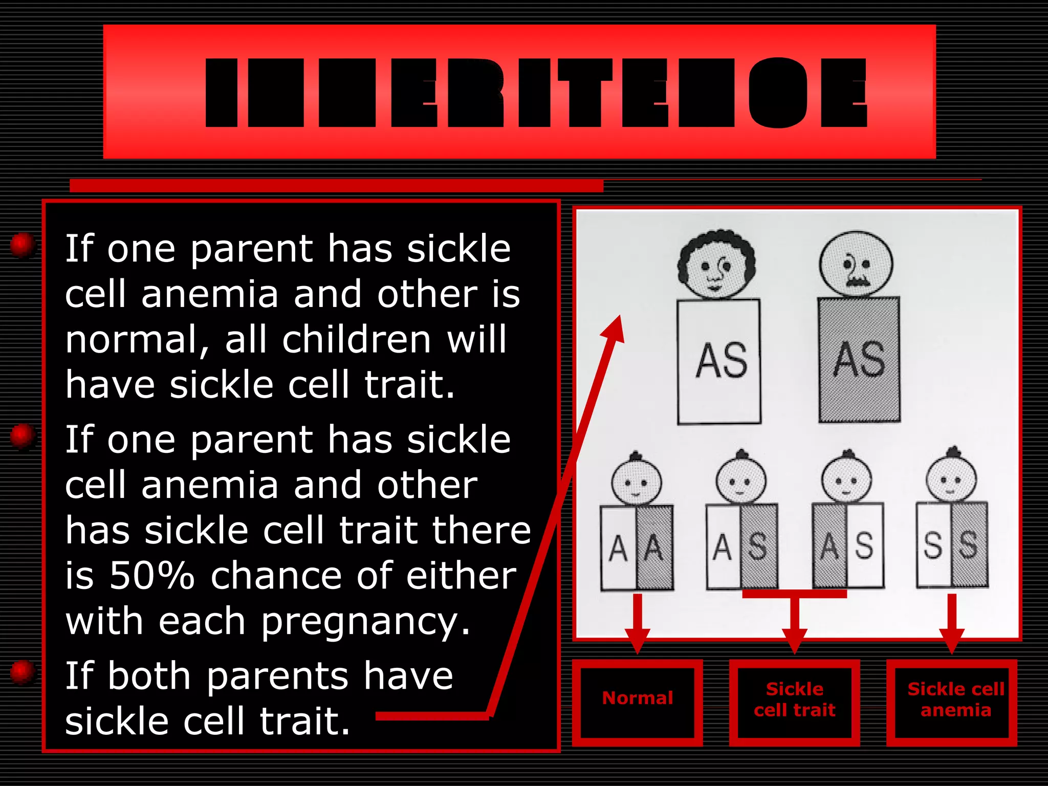 Sickle Cell Anemia | PPT | Blood Disorders | Diseases and Conditions