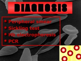 Sickle Cell Anemia | PPT | Blood Disorders | Diseases and Conditions