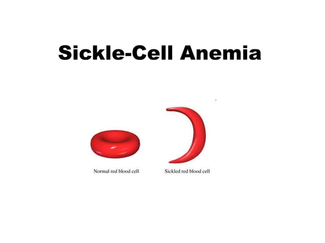Sickle-Cell-Anemia-Powerpoint presentation | PPTX