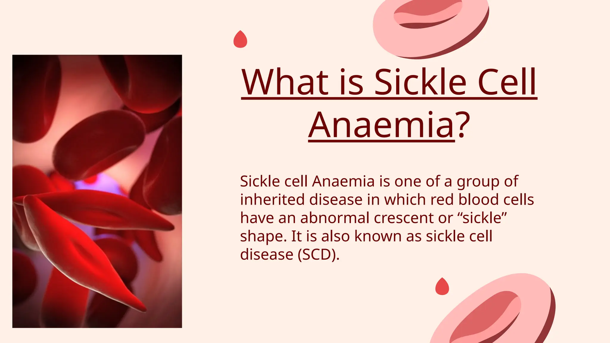 Comprehensive Overview of Sickle Cell Anemia: Causes, Symptoms ...
