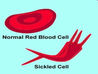 Sickle Cell Good | PPT