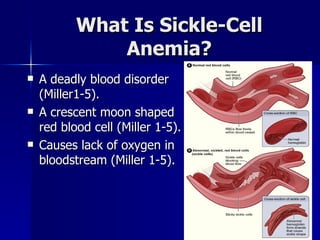 Period 3/Anthony Davis/Sickle-Cell Anemia | PPT