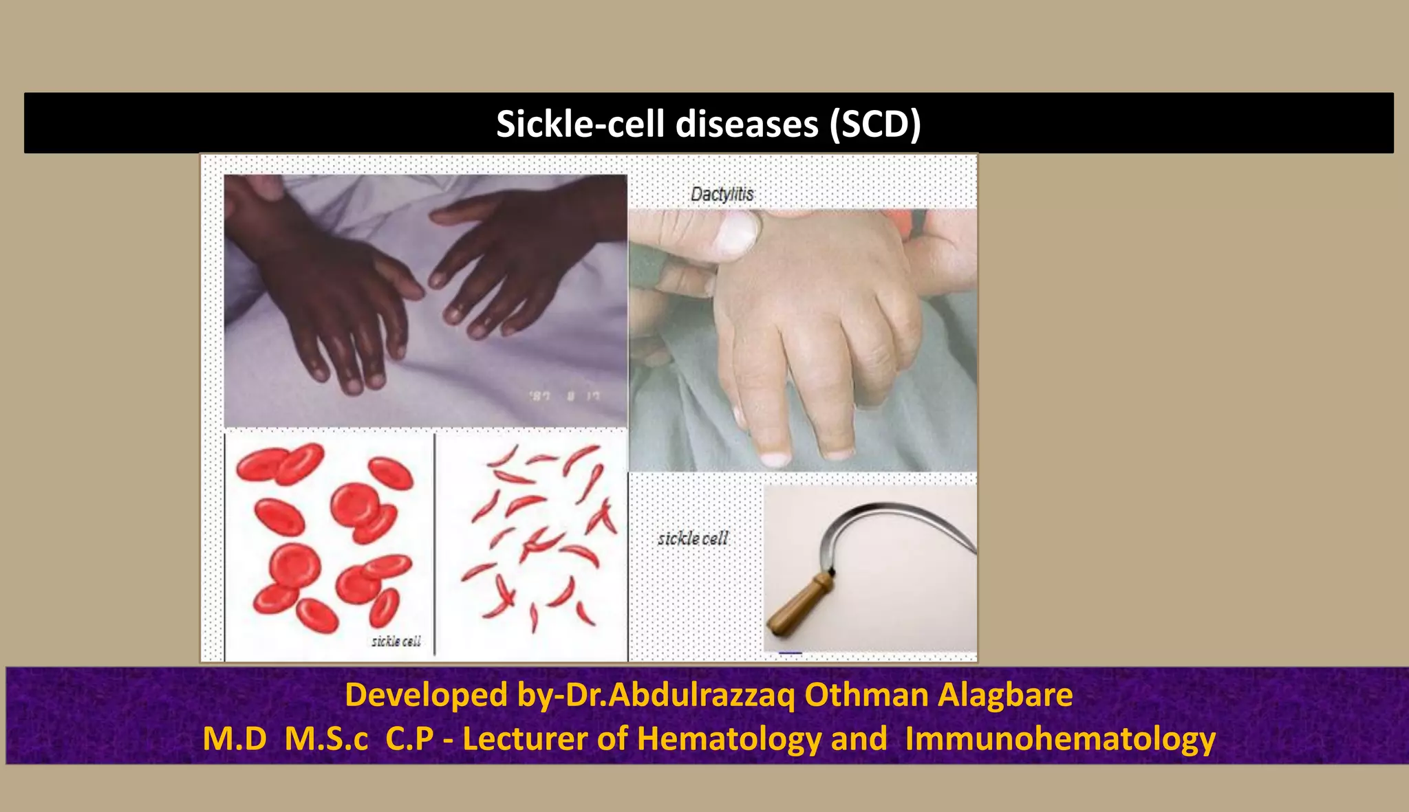 Sickle cell diseases (SCD) | PDF