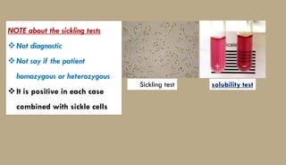 Sickle cell diseases (SCD) | PDF