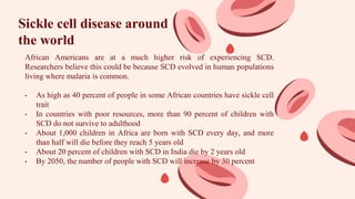 Sickle Cell Anemia by Mohammed kareem | PPTX