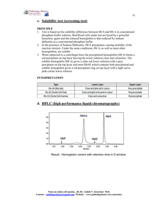 Sickle cell Anemia | PDF