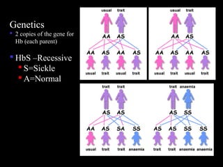 Sickle cell | PPT