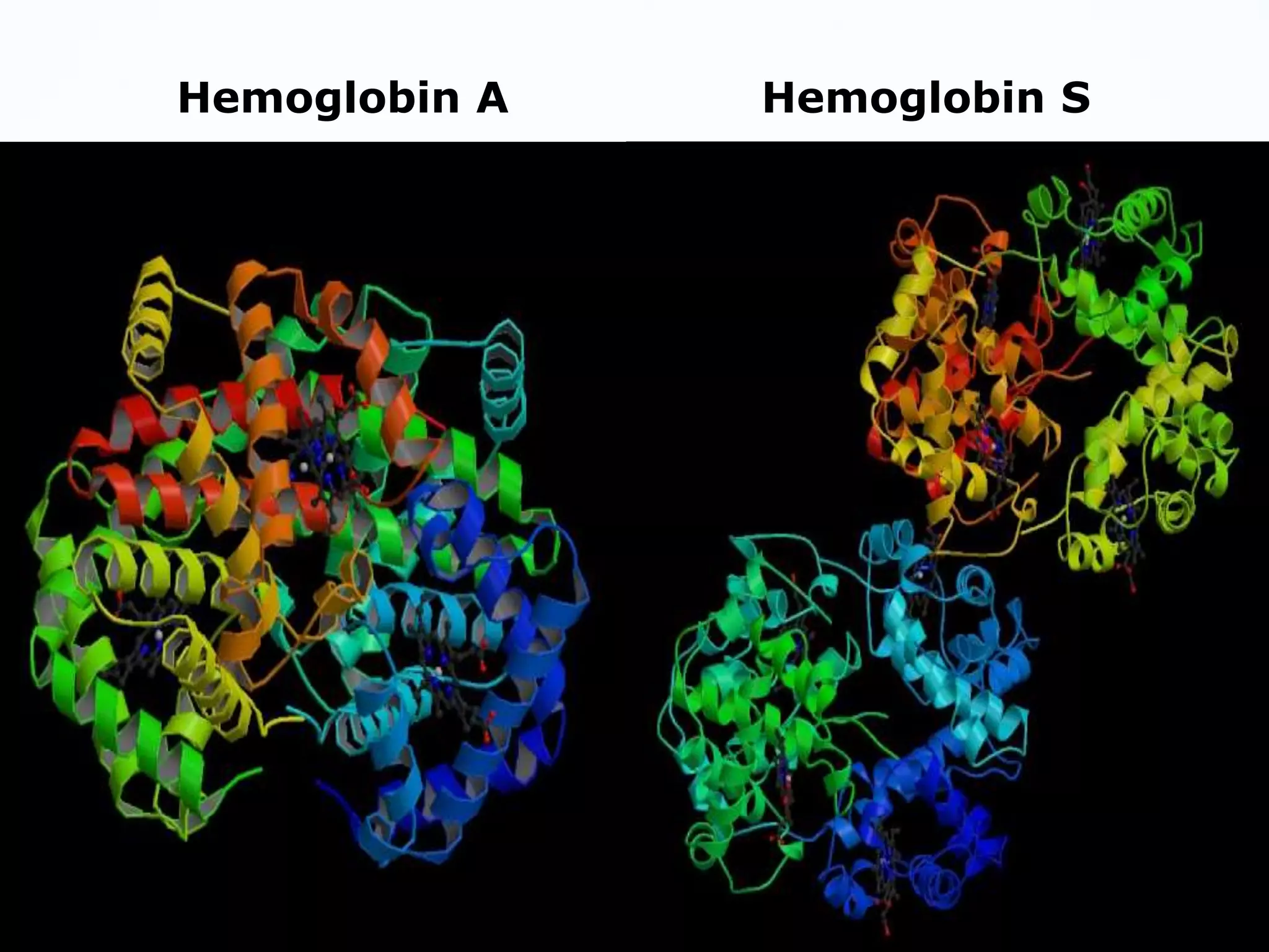 Sickle cell anemia | PPTX