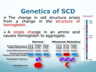 Sickle Cell Anemia Mutation
