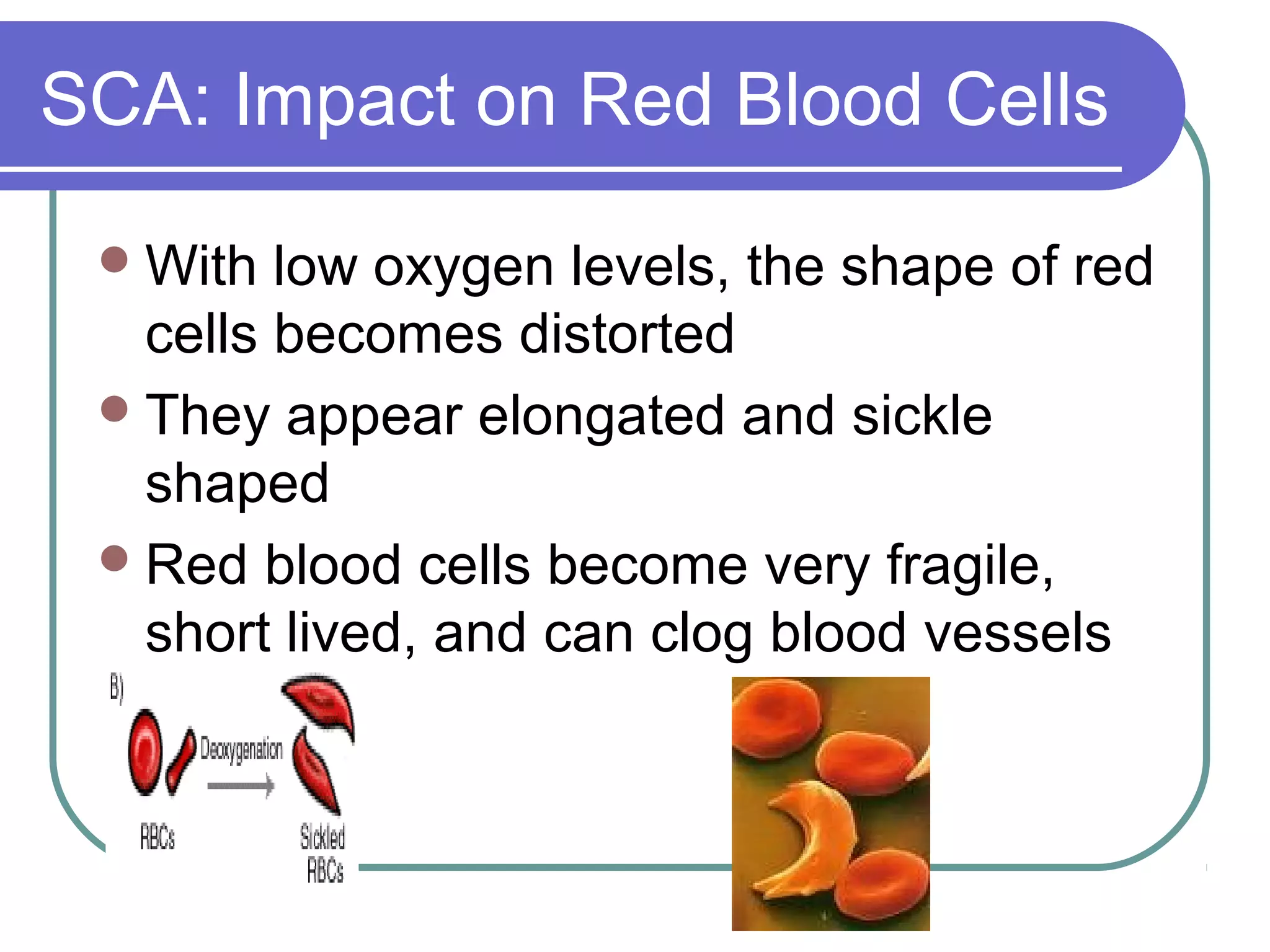Sicklecell | PPT