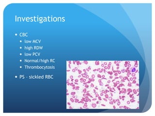 Sickle cell anaemia | PPTX