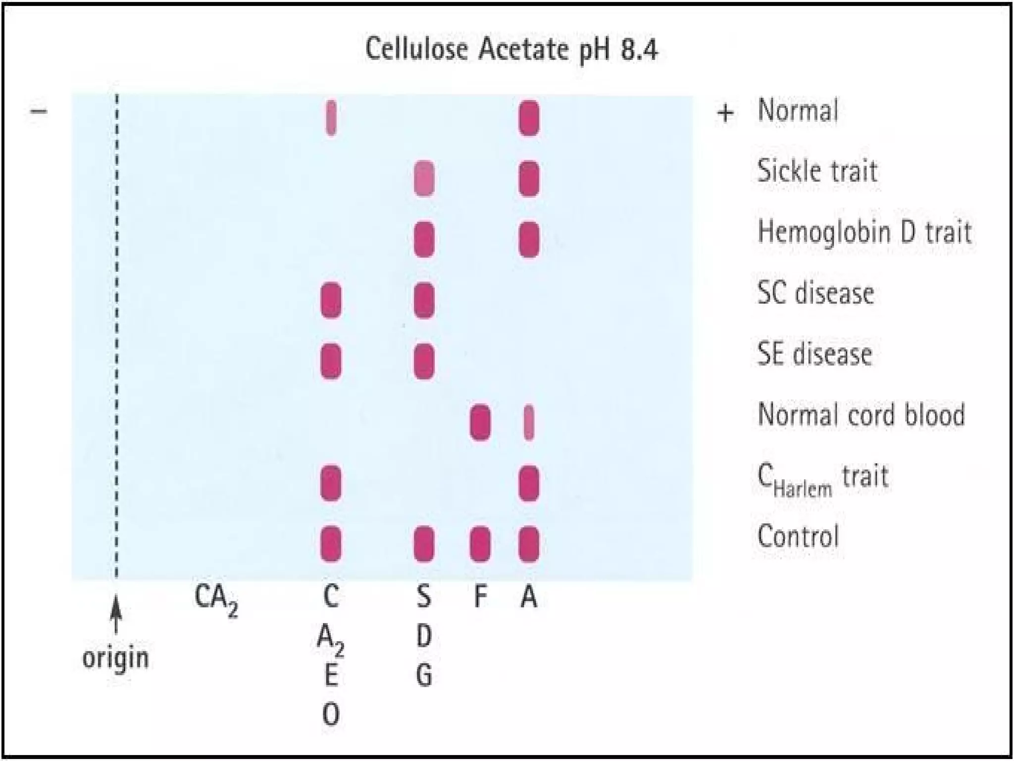 Sickle cell | PPT