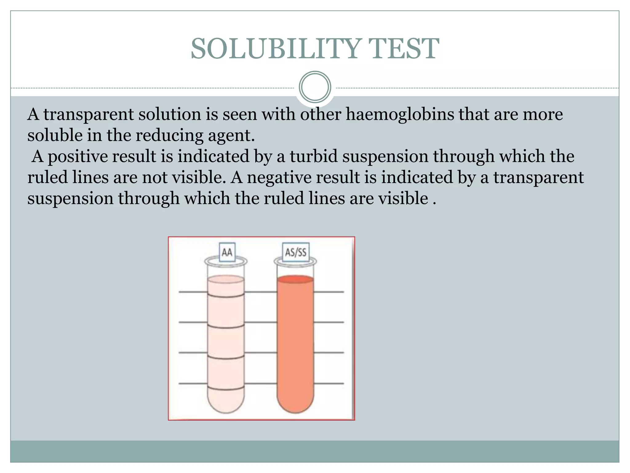 Sickle cell anaemia | PPTX