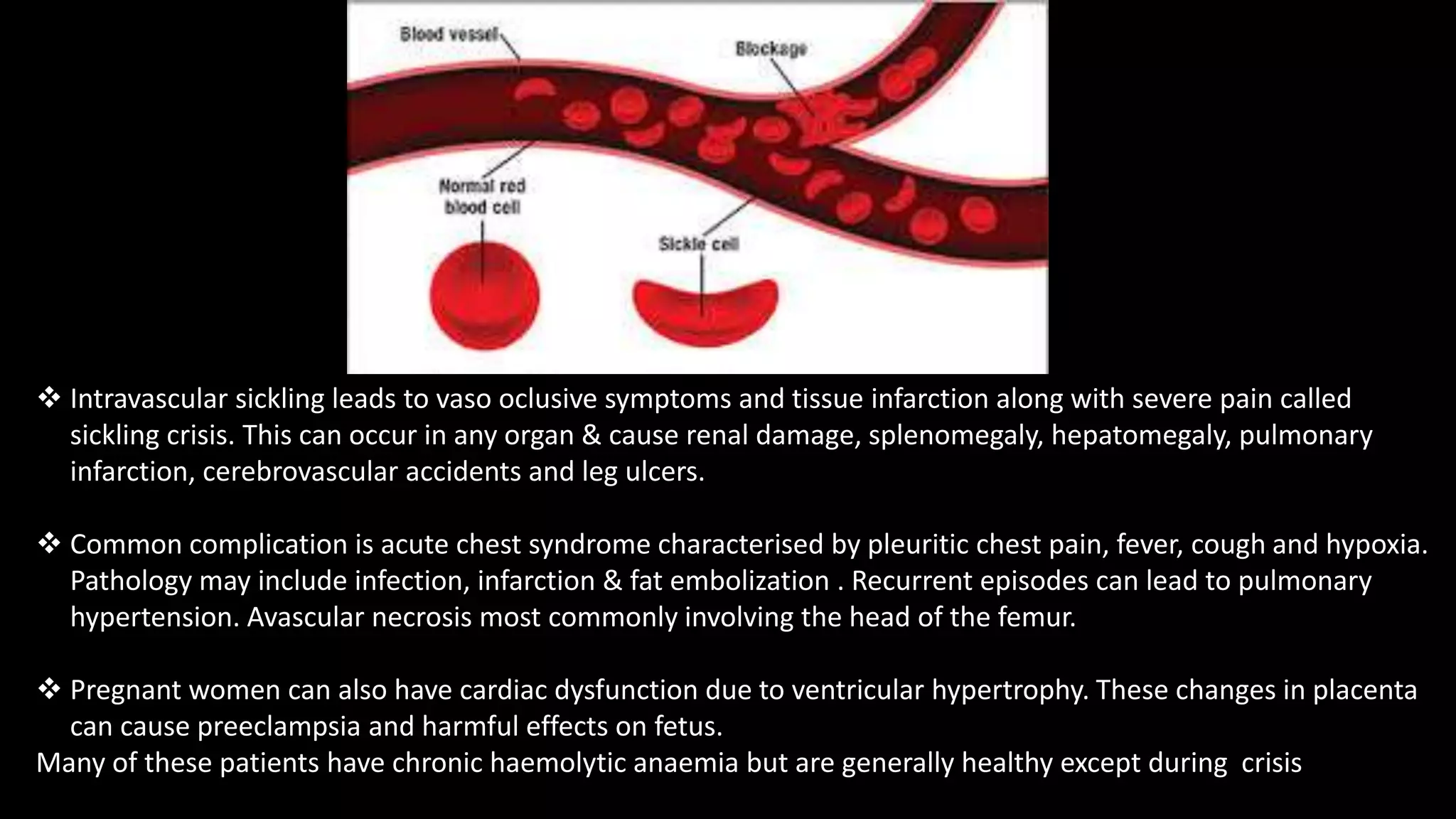 SICKLE CELL ANAEMIA IN PREGNANCY FOR MBBS UNDER GRADUATES OBG | PPTX
