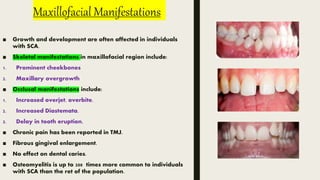 Sickle cell anaemia | PPT