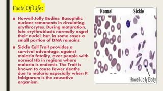 Sickle cell anaemia | PPTX