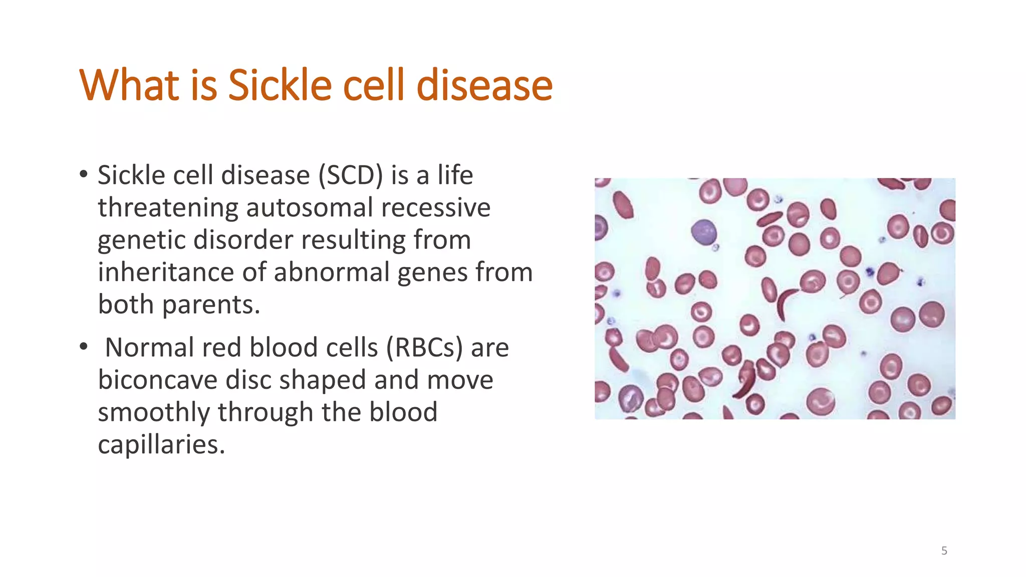 Sickle cell anaemia | PPTX