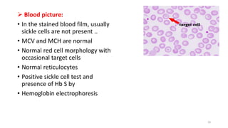 Sickle cell anaemia | PPTX
