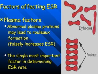 Sickle Cell and ESR laboratory methods.ppt