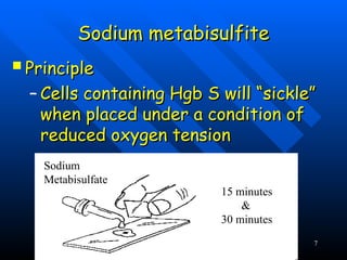 Sickle Cell and ESR laboratory methods.ppt