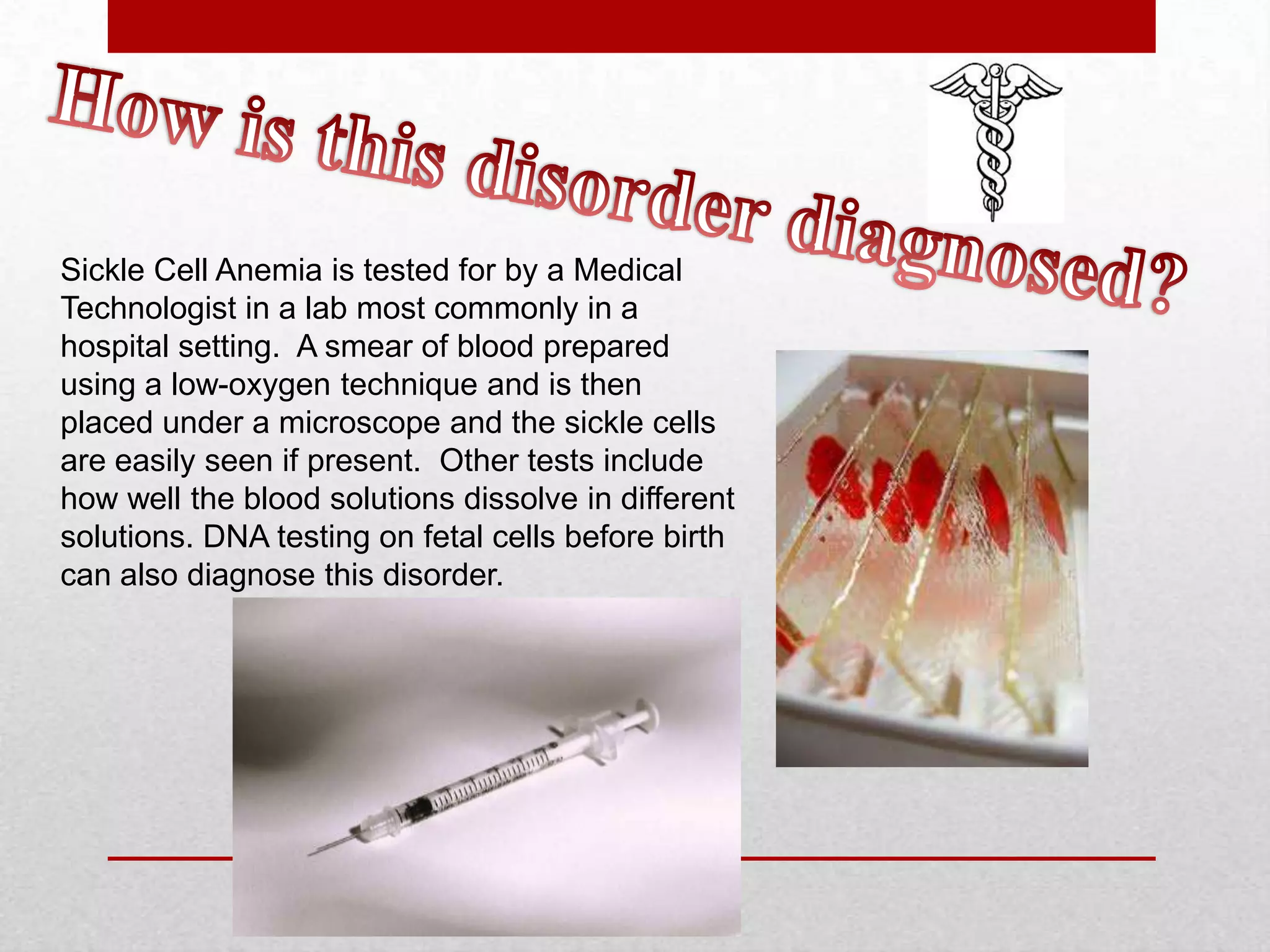 Sickle cell anemia | PPTX