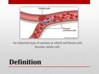 Sickle cell anemia | PPT