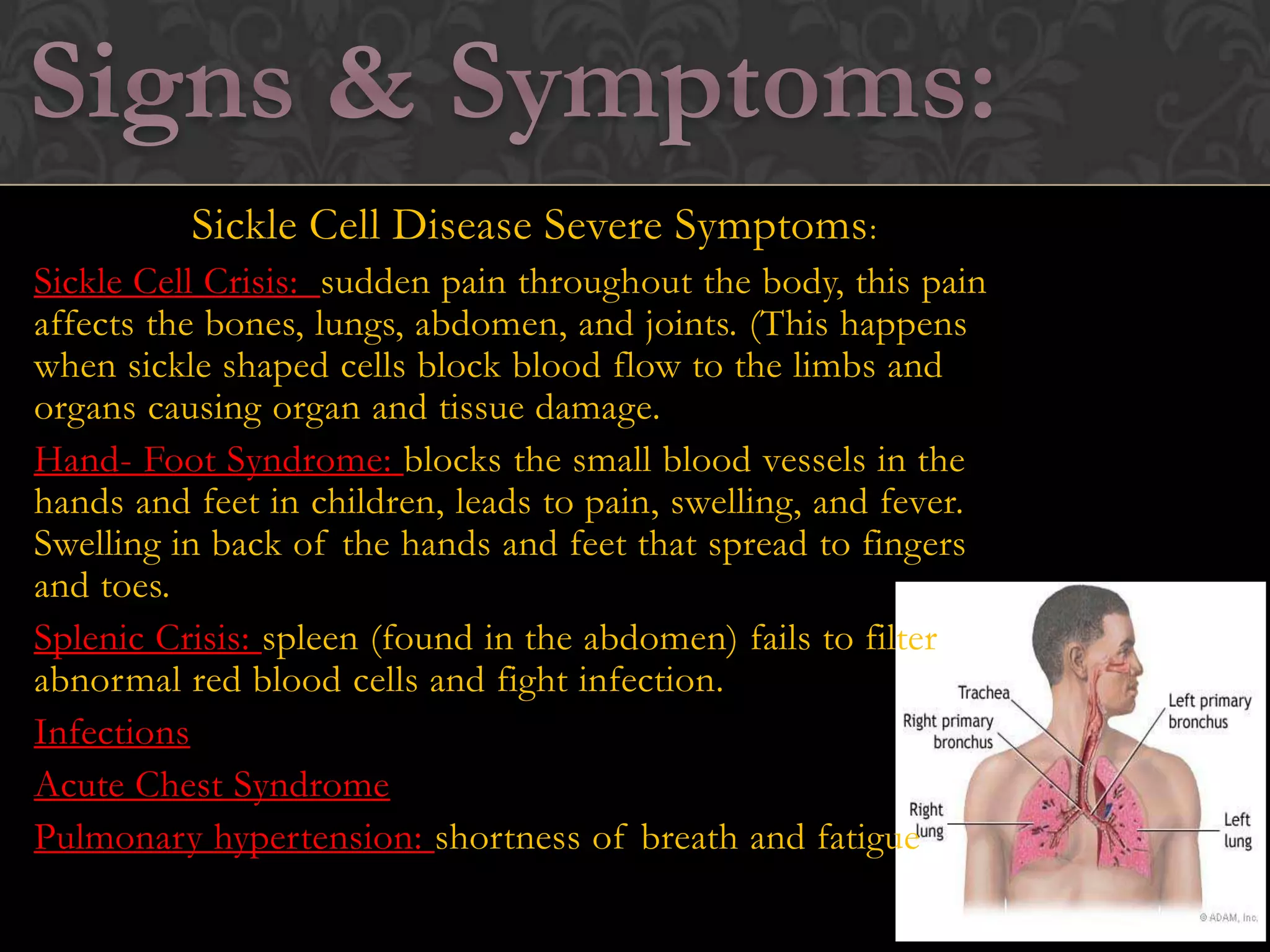 Sickle Cell Anemia | PPTX