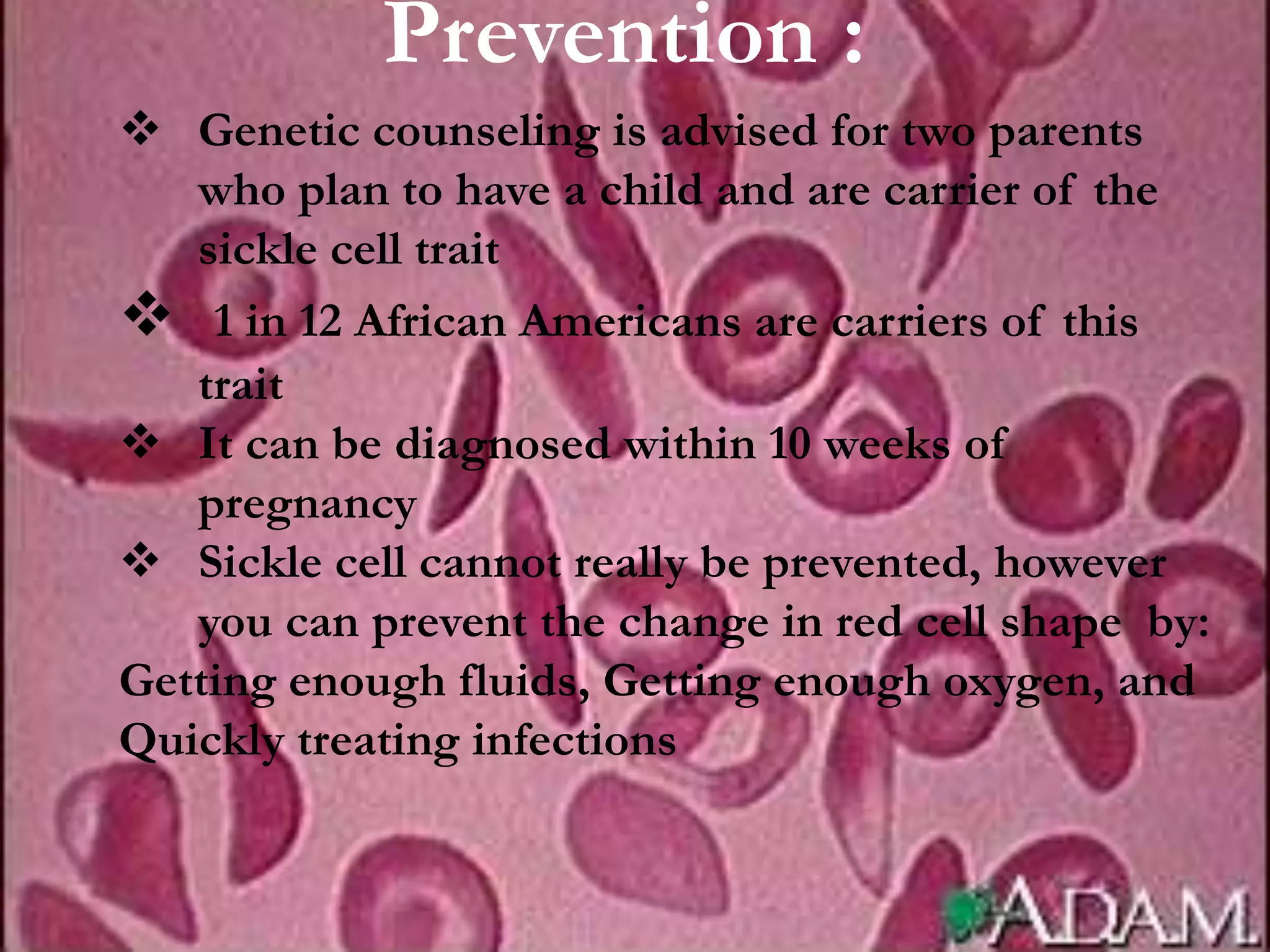 Sickle Cell Anemia | PPTX