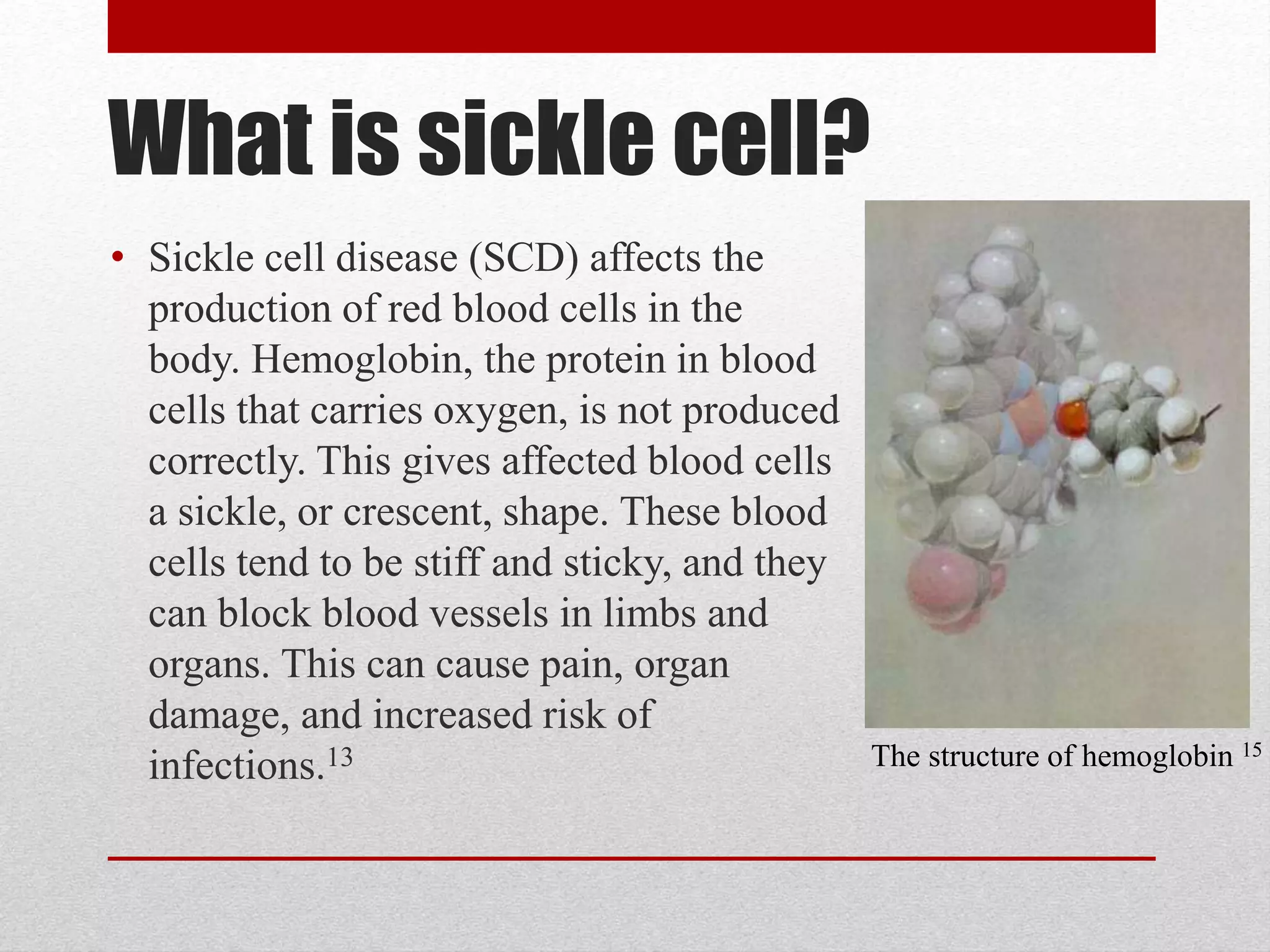 Sickle cell anemia | PPTX