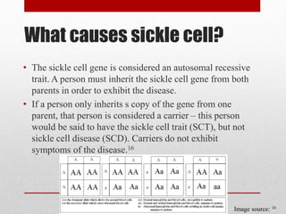 Sickle cell anemia | PPTX