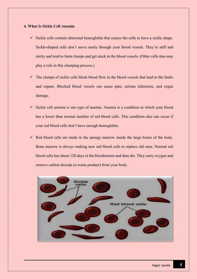 Sickle cell anemia | PDF