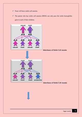 Sickle cell anemia | PDF