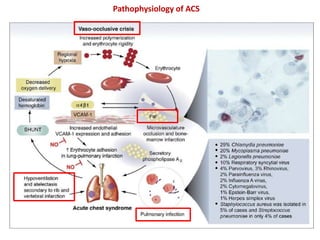 Sickle cell anemia | PPTX
