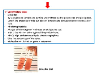 Sickle cell anemia | PPT