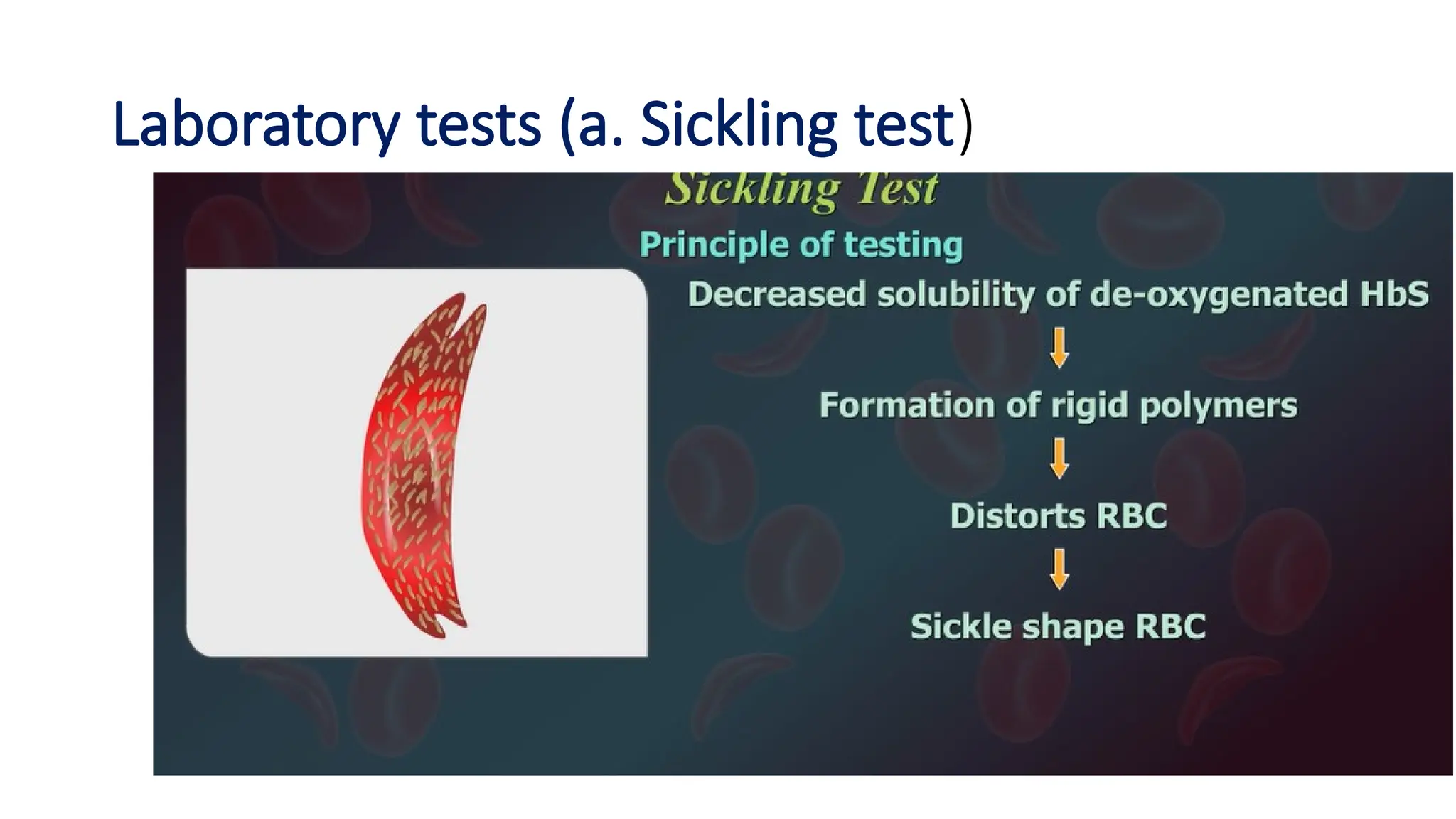 Sickle Cell Anemia.pptxSickle Cell Anemia | PPT