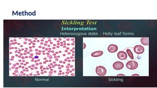Sickle Cell Anemia.pptxSickle Cell Anemia | PPT