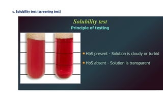 Sickle Cell Anemia.pptxSickle Cell Anemia | PPT