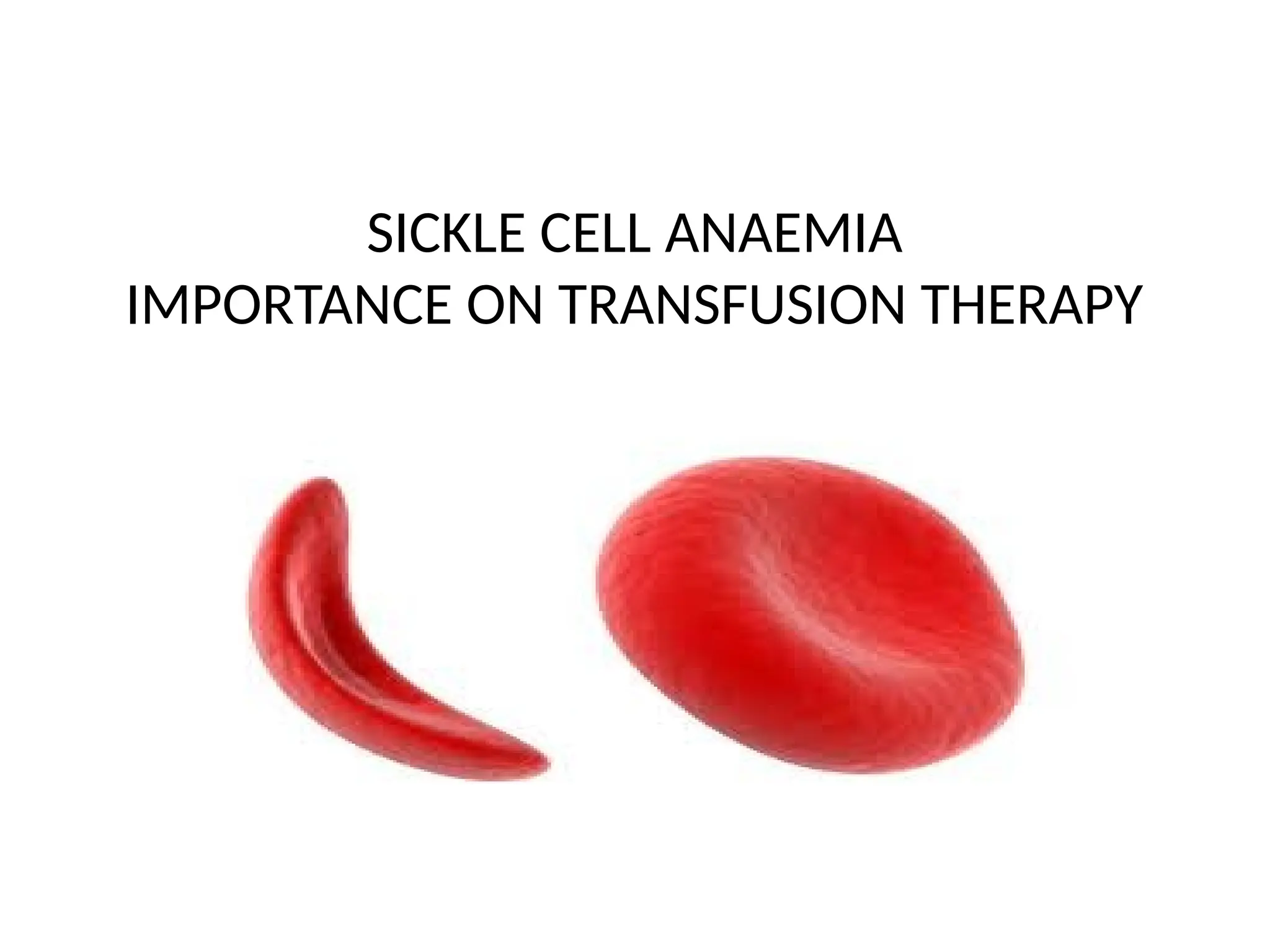 sickle cell anemia importance of transfusion therapy | PPT