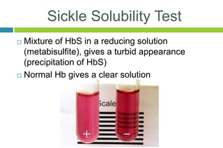 Sickle cell anemia | Hemoglobinopathies | PPTX