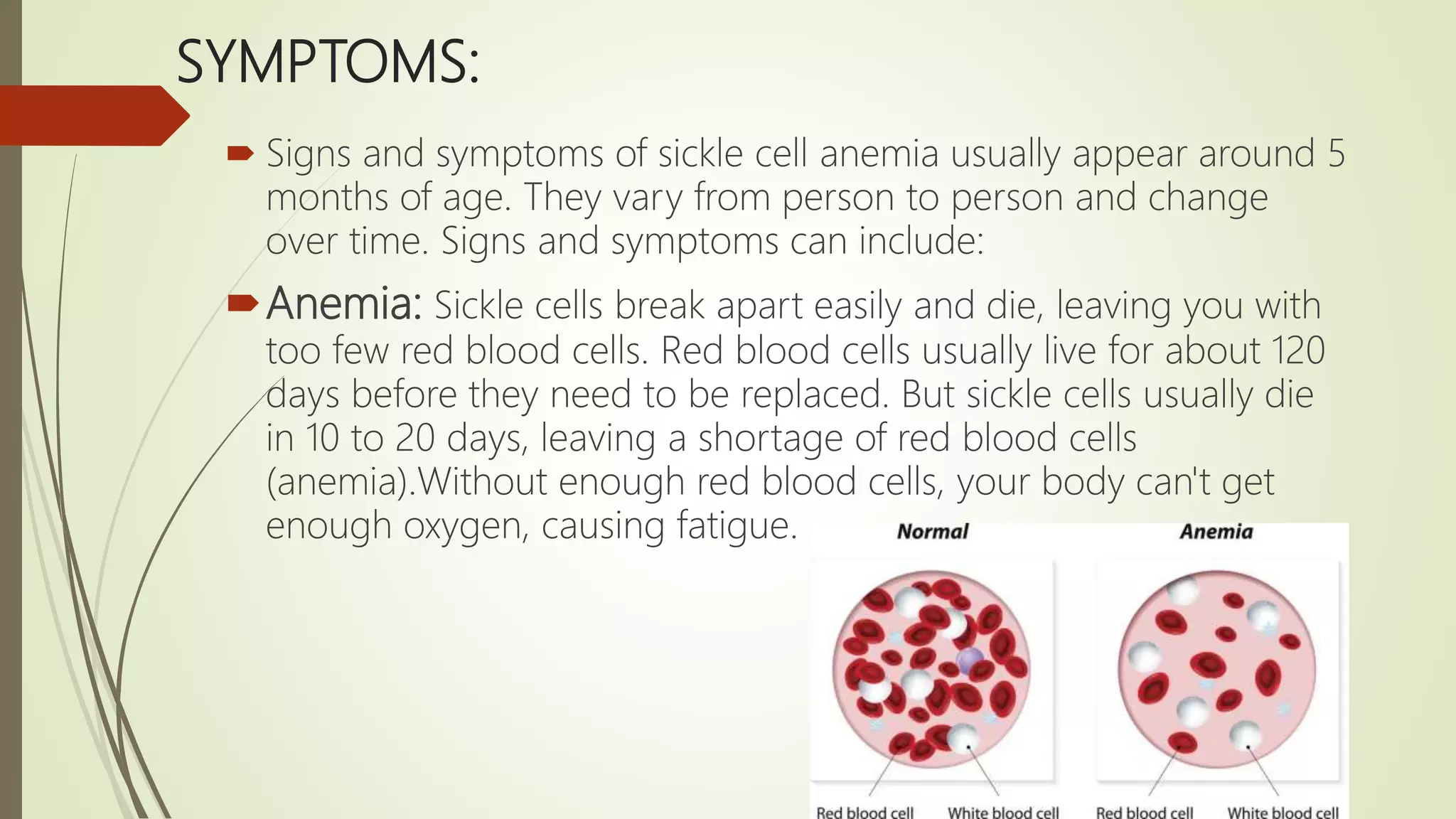 Sickle Cell Anemia Symptomspptx