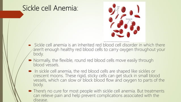 Sickle Cell Anemia Symptomspptx