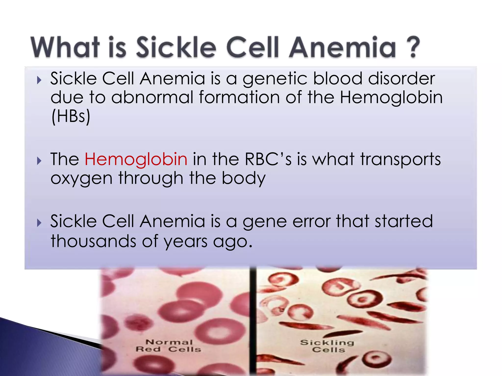 Sickle Cell Anemia | PPTX