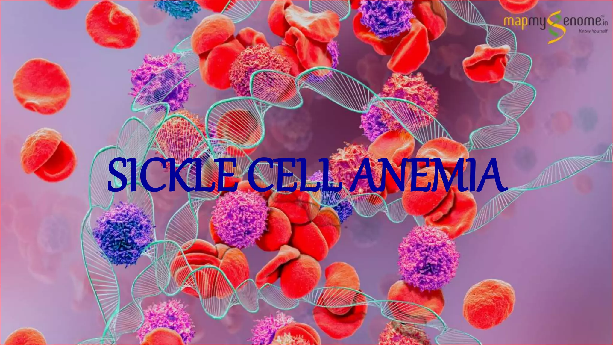 Sickle cell anemia | PPTX