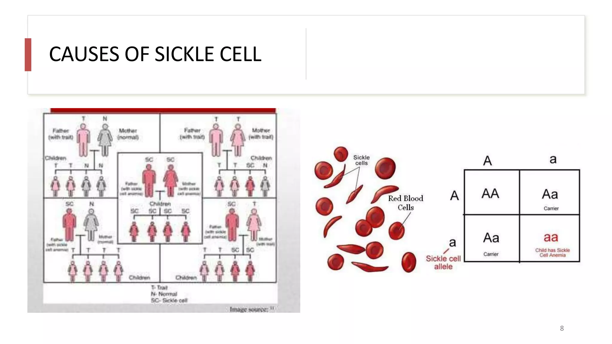 Sickle Cell Anemia 2.pptx