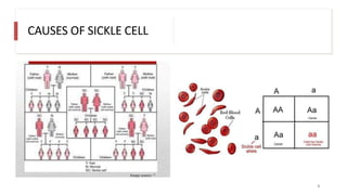 Sickle Cell Anemia 2.pptx