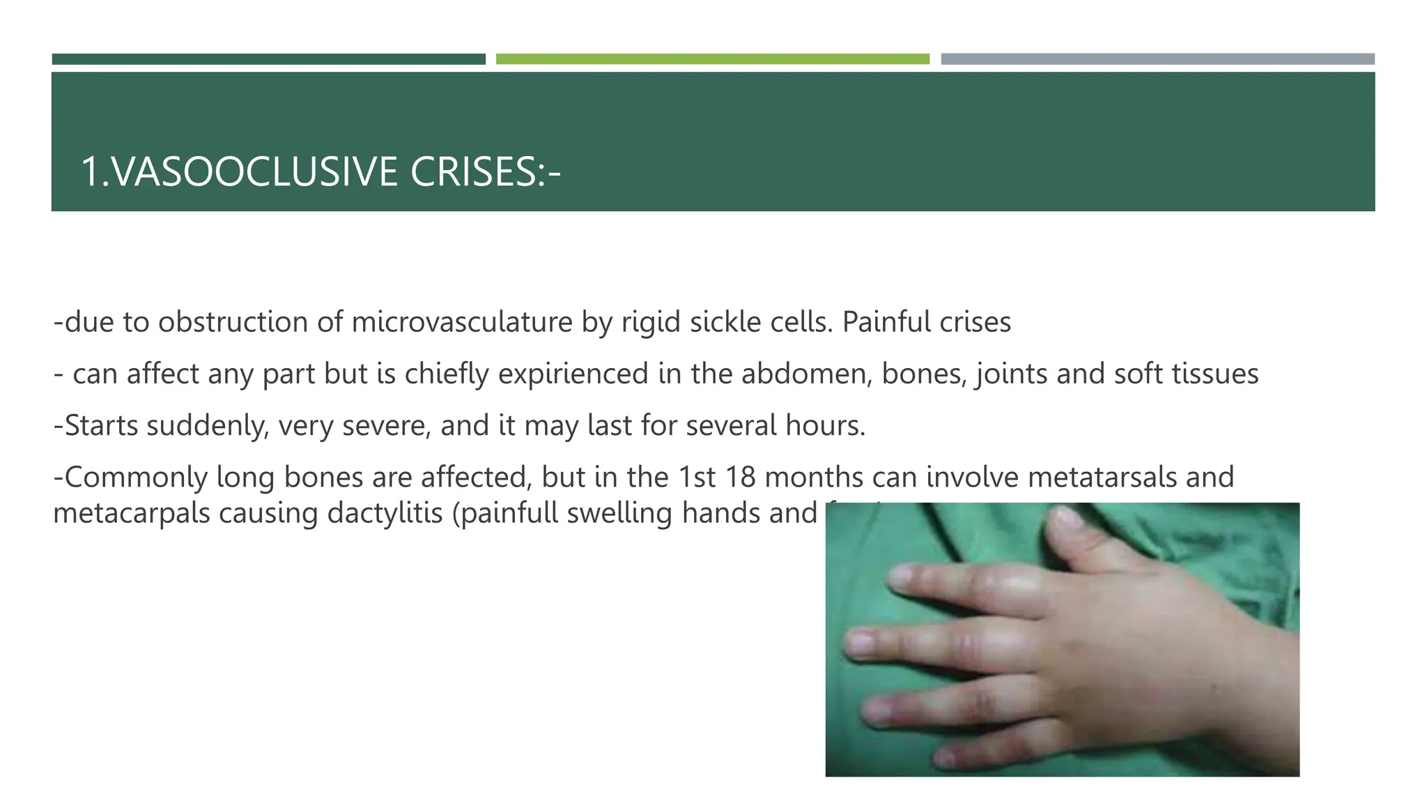 pediatrics 6. Sickle Cell Anemia 6.1.pptx